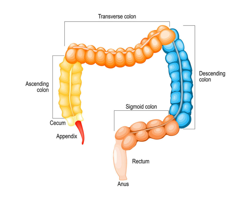 Dr Neeraj Singh - Colon & Rectal Care Center of Phoenix